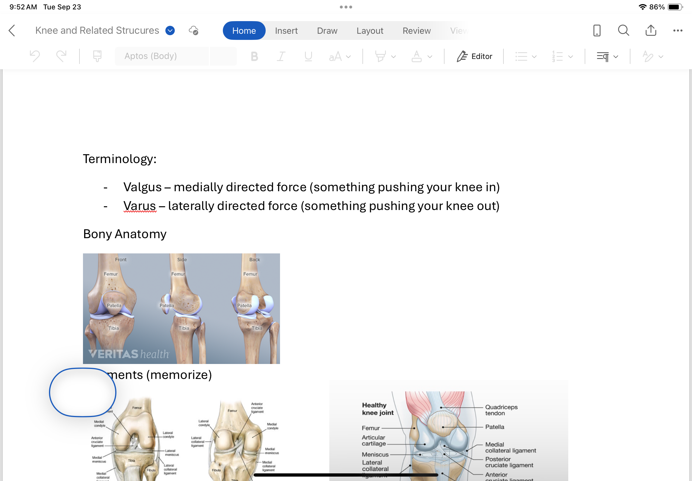 Weird Magnifying Glass - Microsoft Q&A
