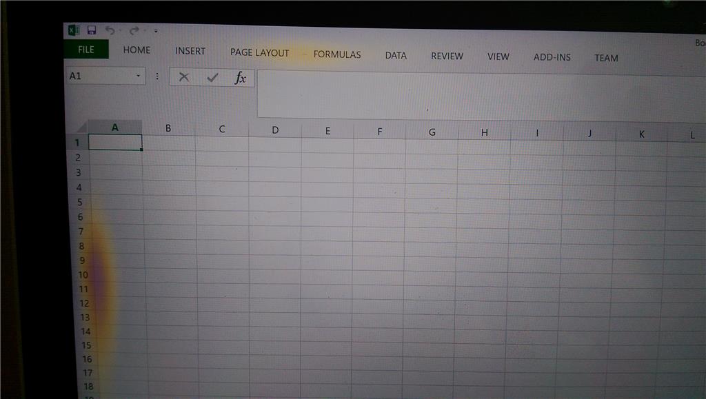 Discoloration at bottom of laptop? - Microsoft Q&A