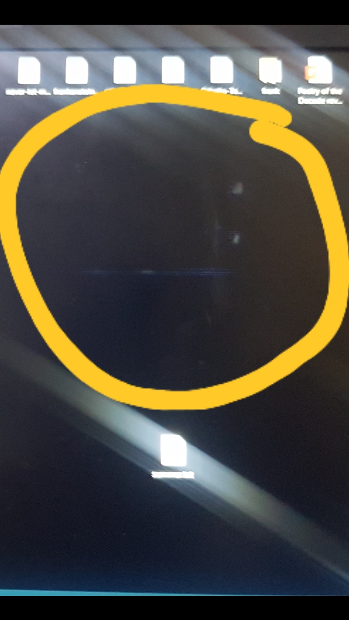 My screen has weird lines/dots - Microsoft Q&A